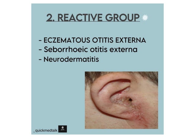 Acute otitis externa.pdf ENT BY QUICKMEDTALK | PDF