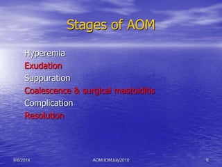 Acute otitis media | PPT