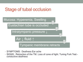 acuteotitismedia-160619103413.pptx