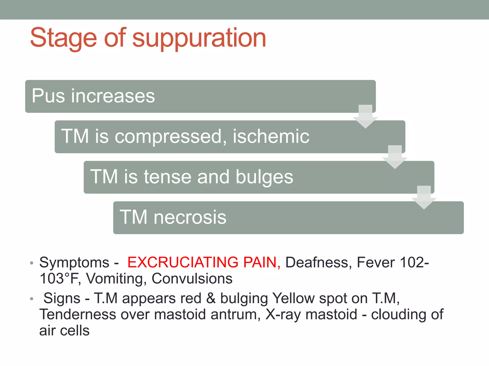 Acute otitis media | PPTX