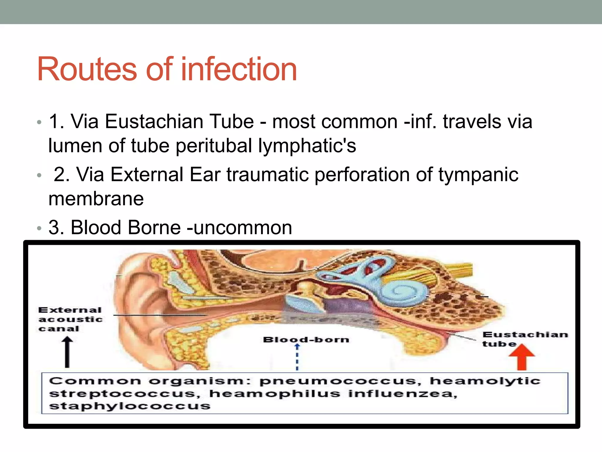 Acute otitis media | PPTX