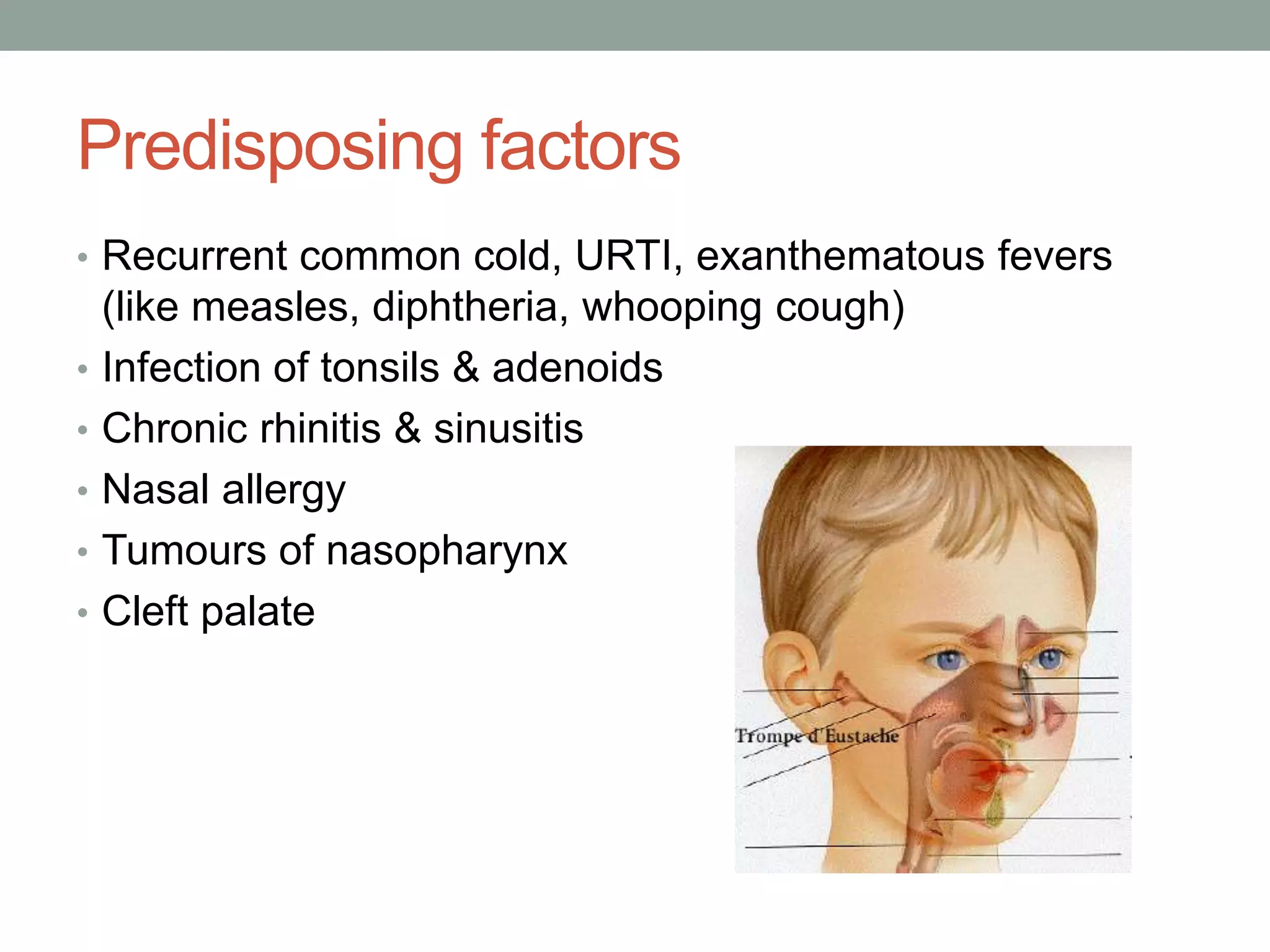 Acute otitis media | PPTX