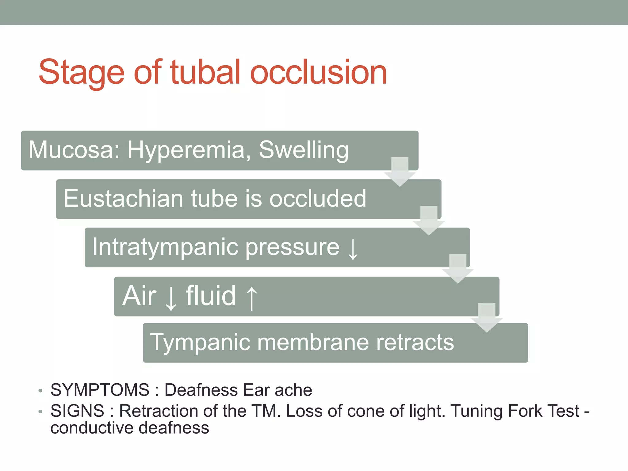 Acute otitis media | PPTX