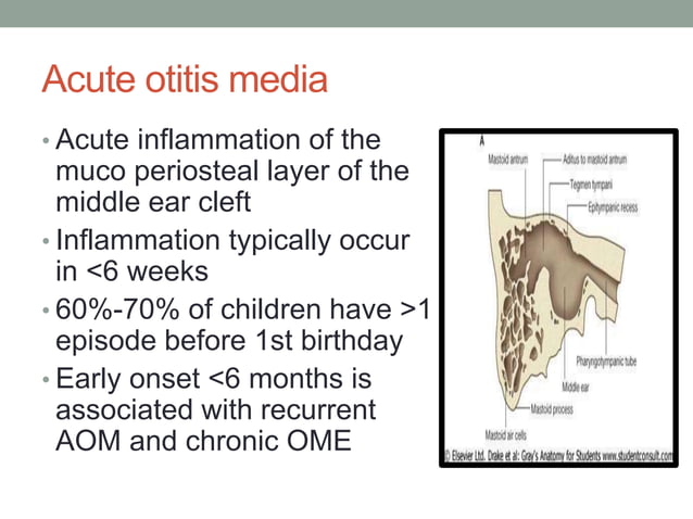 Acute otitis media | PPTX | Ear, Nose and Throat Conditions | Diseases ...