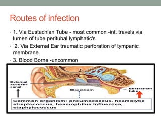Acute otitis media | PPTX