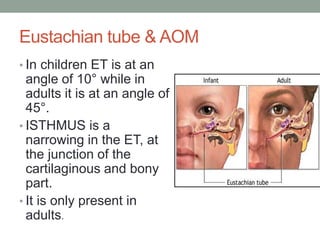 Acute otitis media | PPTX | Ear, Nose and Throat Conditions | Diseases ...