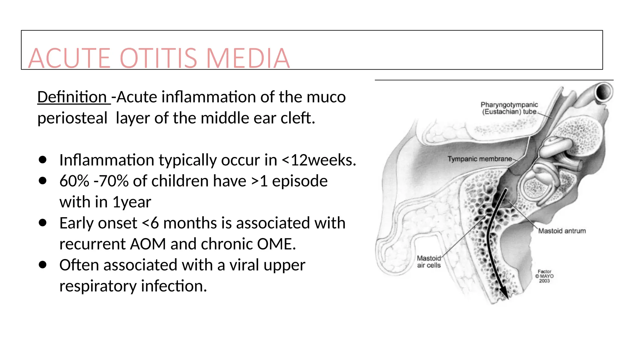 Acute otitis media.pptx . | PPTX