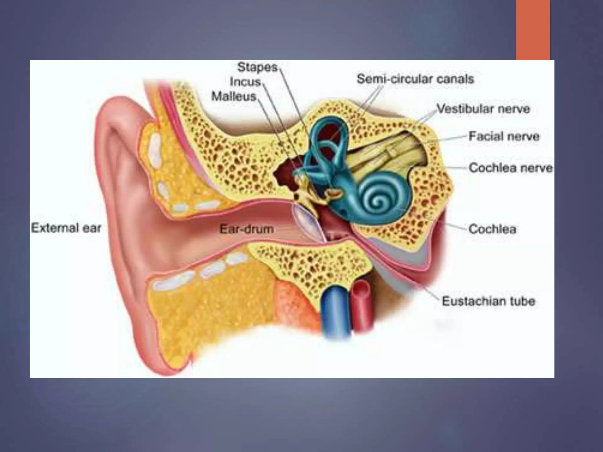 Acute otitis media | PPTX