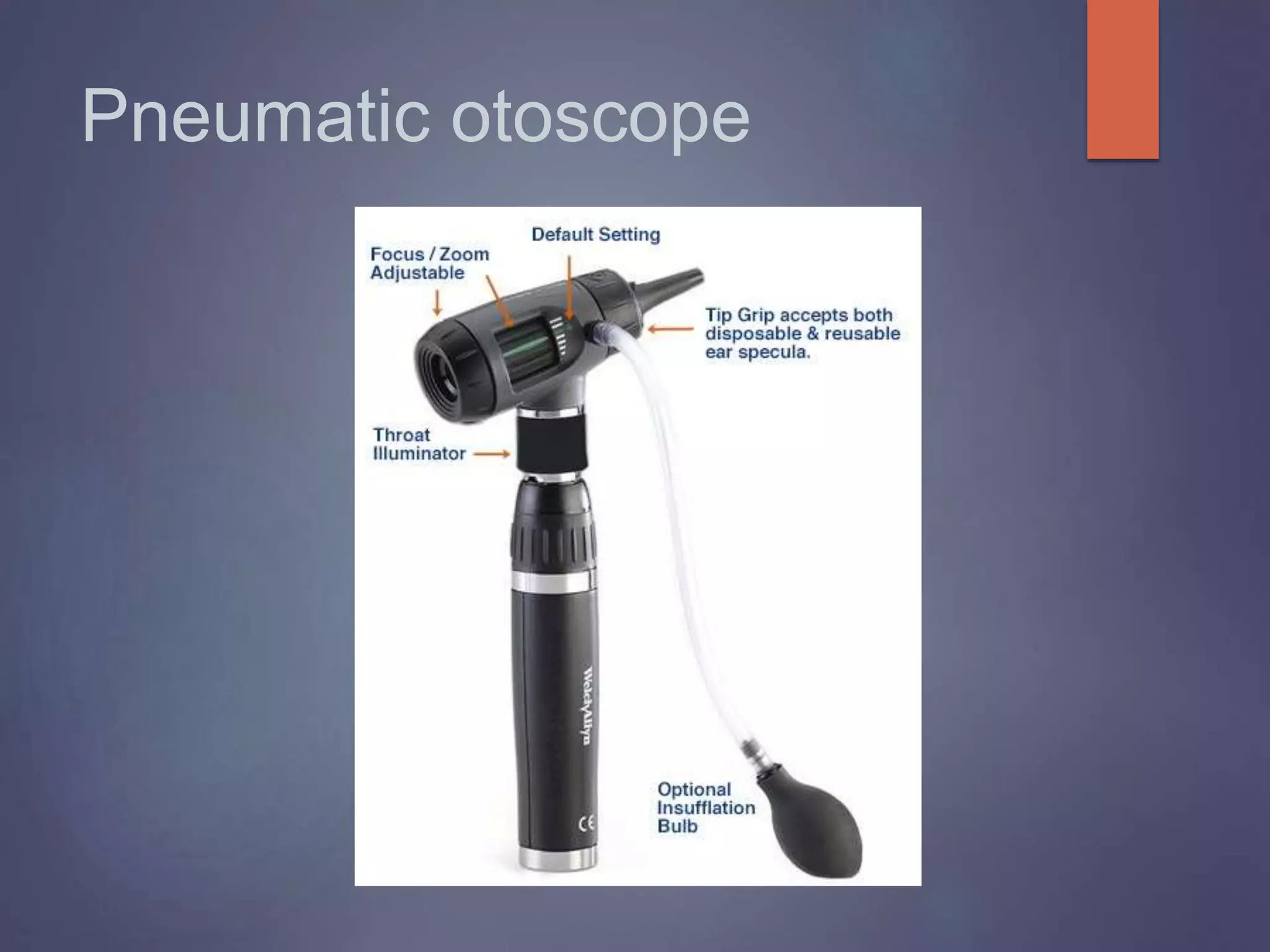 Acute otitis media | PPTX