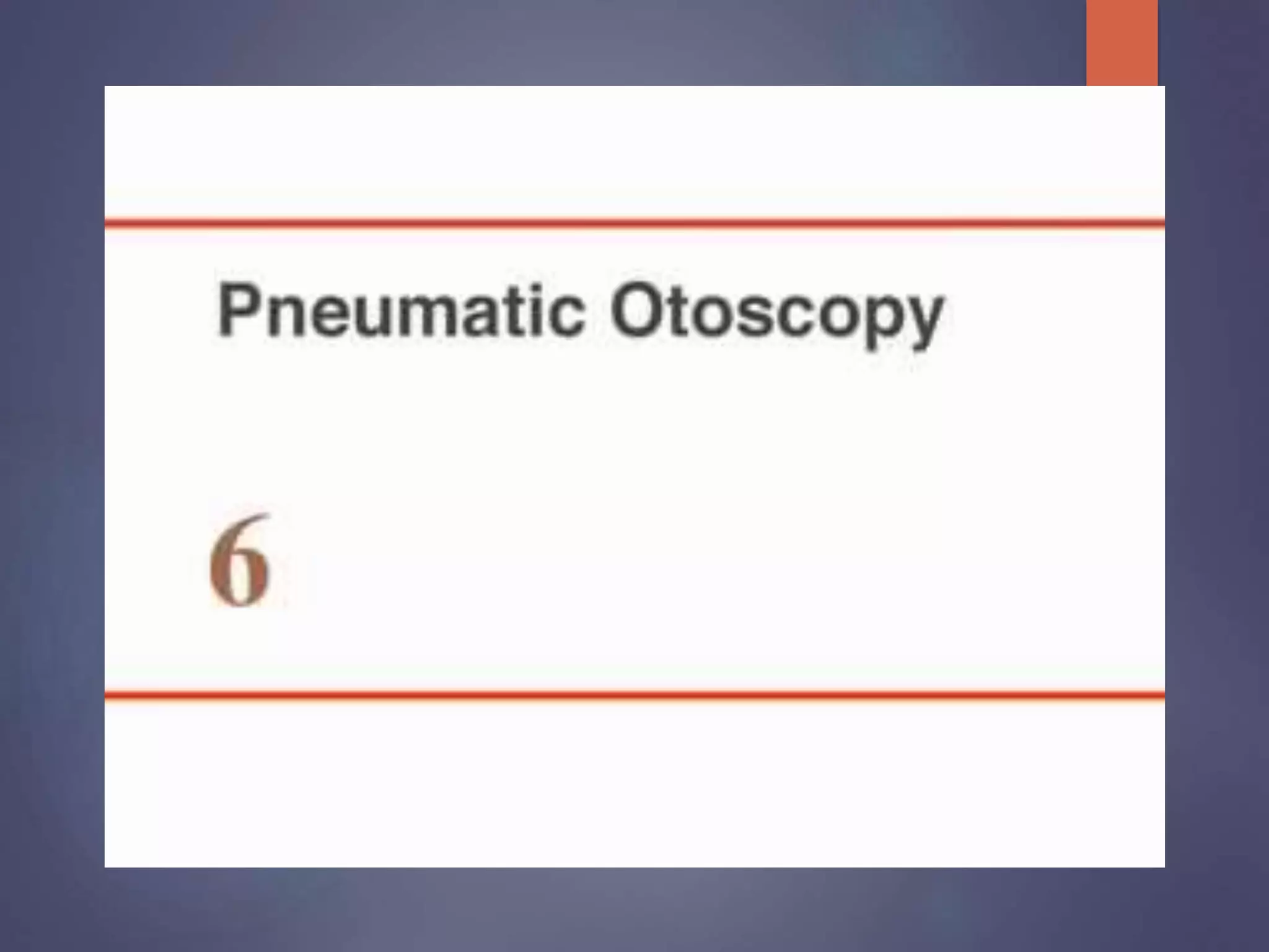 Acute otitis media | PPTX | Ear, Nose and Throat Conditions | Diseases ...
