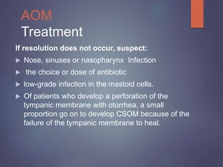 Acute otitis media | PPTX