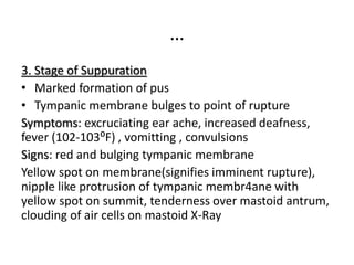 ACUTE OTITIS MEDIA infection of the middle ear | PPT