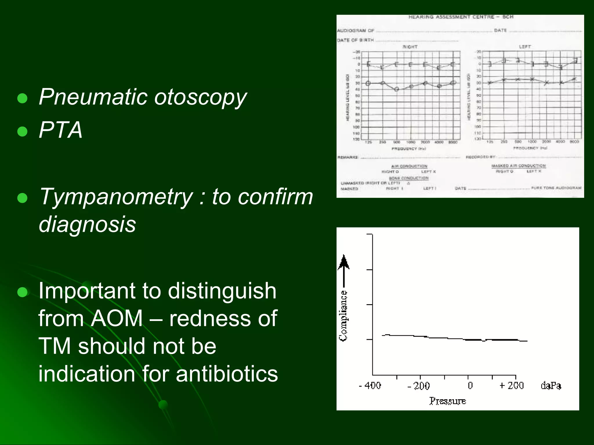 Acute Otitis Media and effusion.pptx