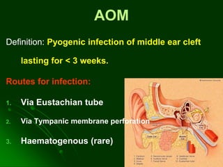 Acute Otitis Media and effusion.pptx
