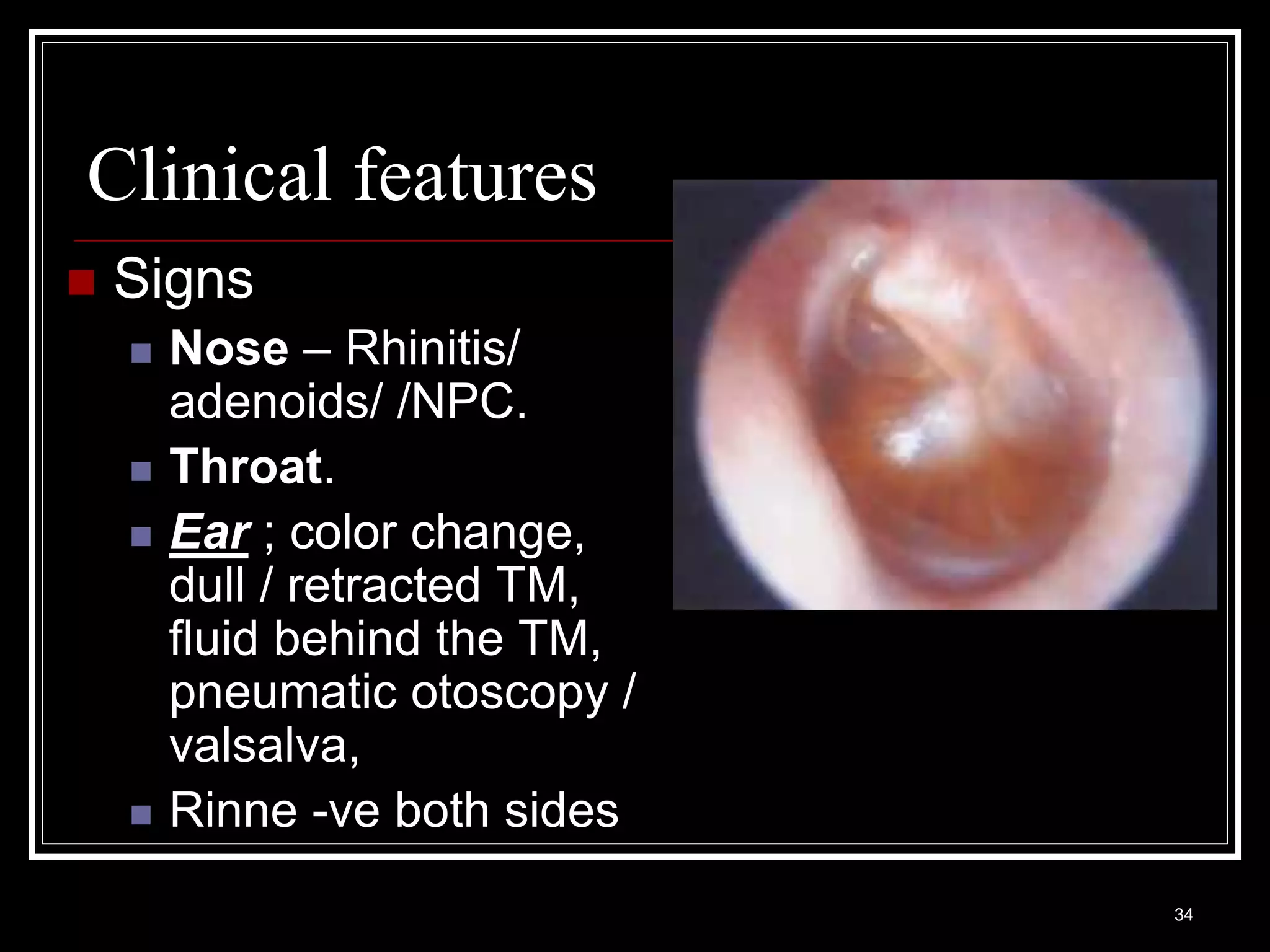 Acute otitis media (AOM) secretory otitis media (OME) | PPT | Ear, Nose ...