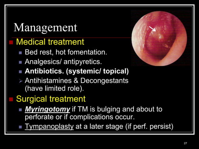 Acute otitis media (AOM) secretory otitis media (OME)