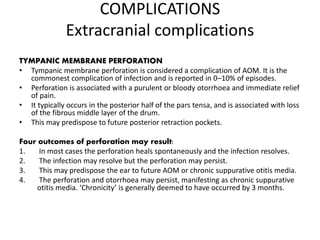 Acute otitis media final | PPTX