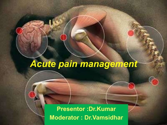 Acute pain and its management | PPTX