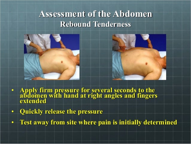 Acute pain abdomen , clinical examination and reaching for a diagnosis