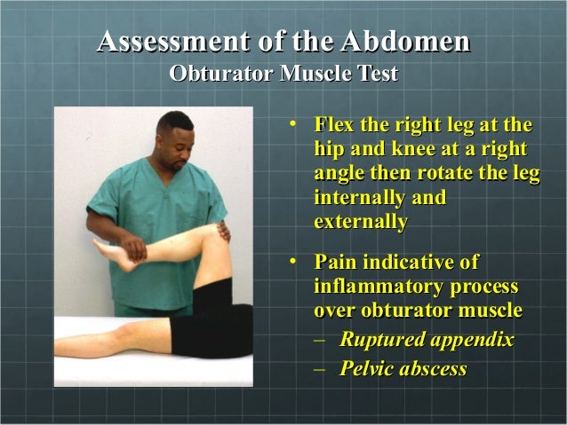 Acute pain abdomen , clinical examination and reaching for a diagnosis