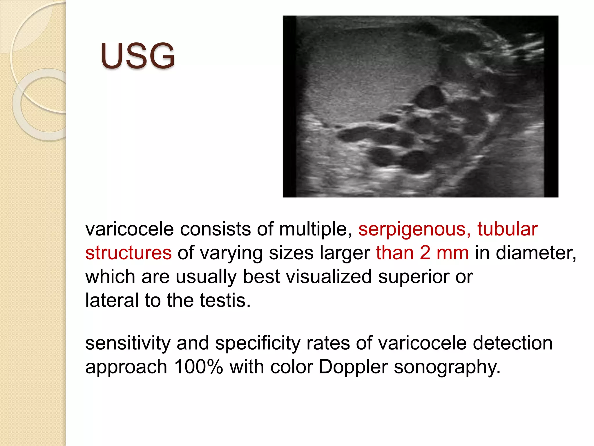 Acute painful scrotum | PPTX