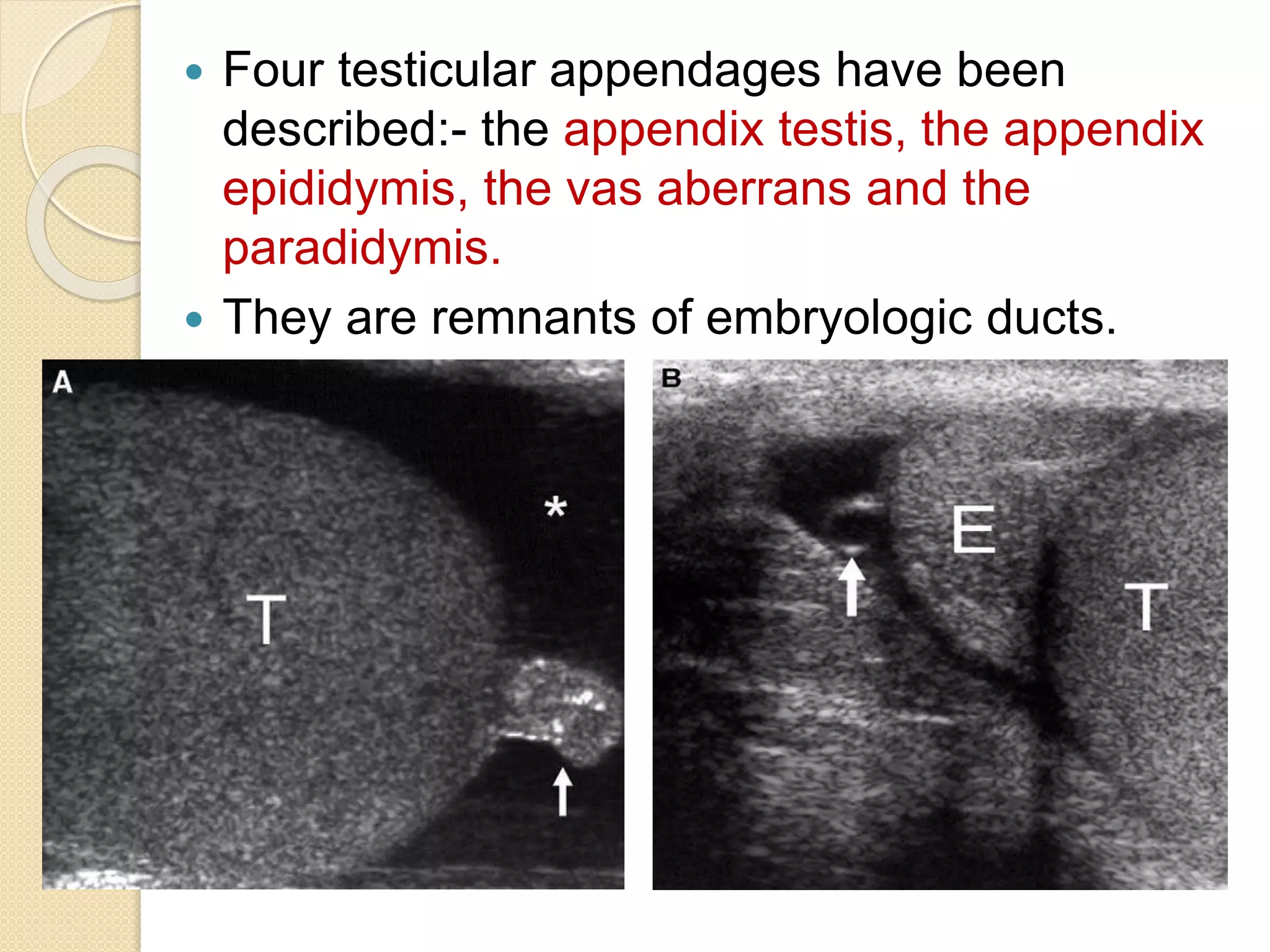 Acute painful scrotum | PPTX