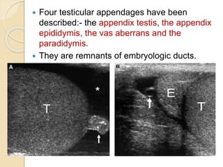 Acute painful scrotum | PPTX