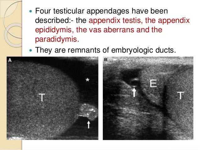 Testis Appendix Anatomy