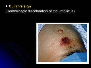 Acute Pancreatitis | PPT