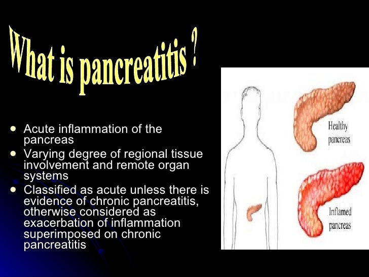 Acute Pancreatitis