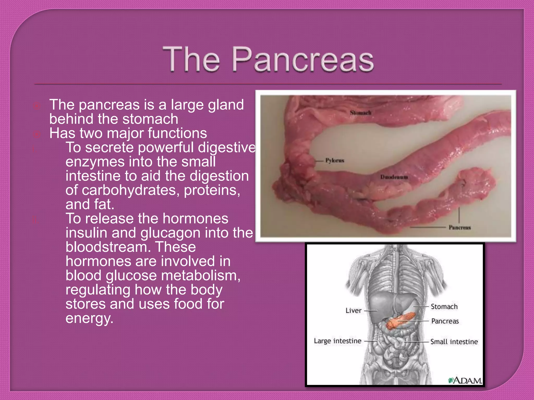 Acute pancreatitis | PPTX