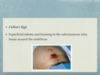 Acute pancreatitis | KEY