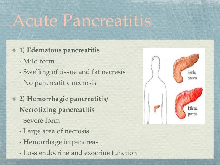 Acute pancreatitis