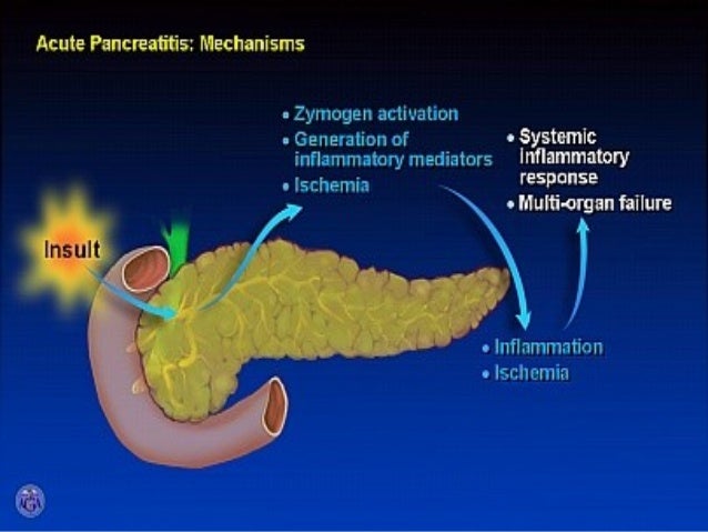 Acute pancreatitis