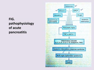 Acute pancreatitis | PPTX