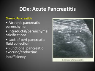Phlegmonous Pancreatitis Ultrasound