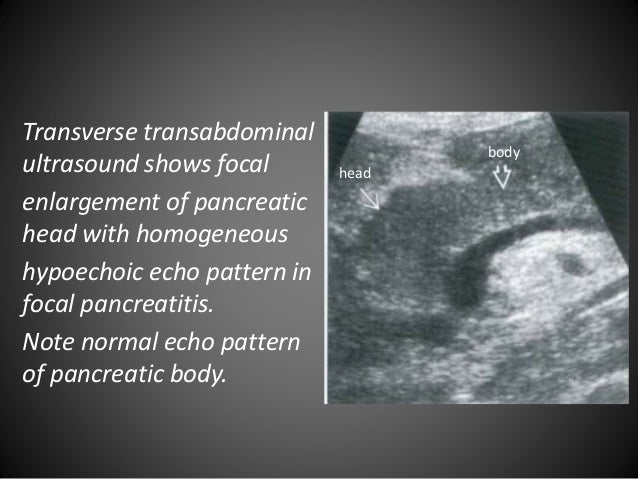 Acute pancreatitis