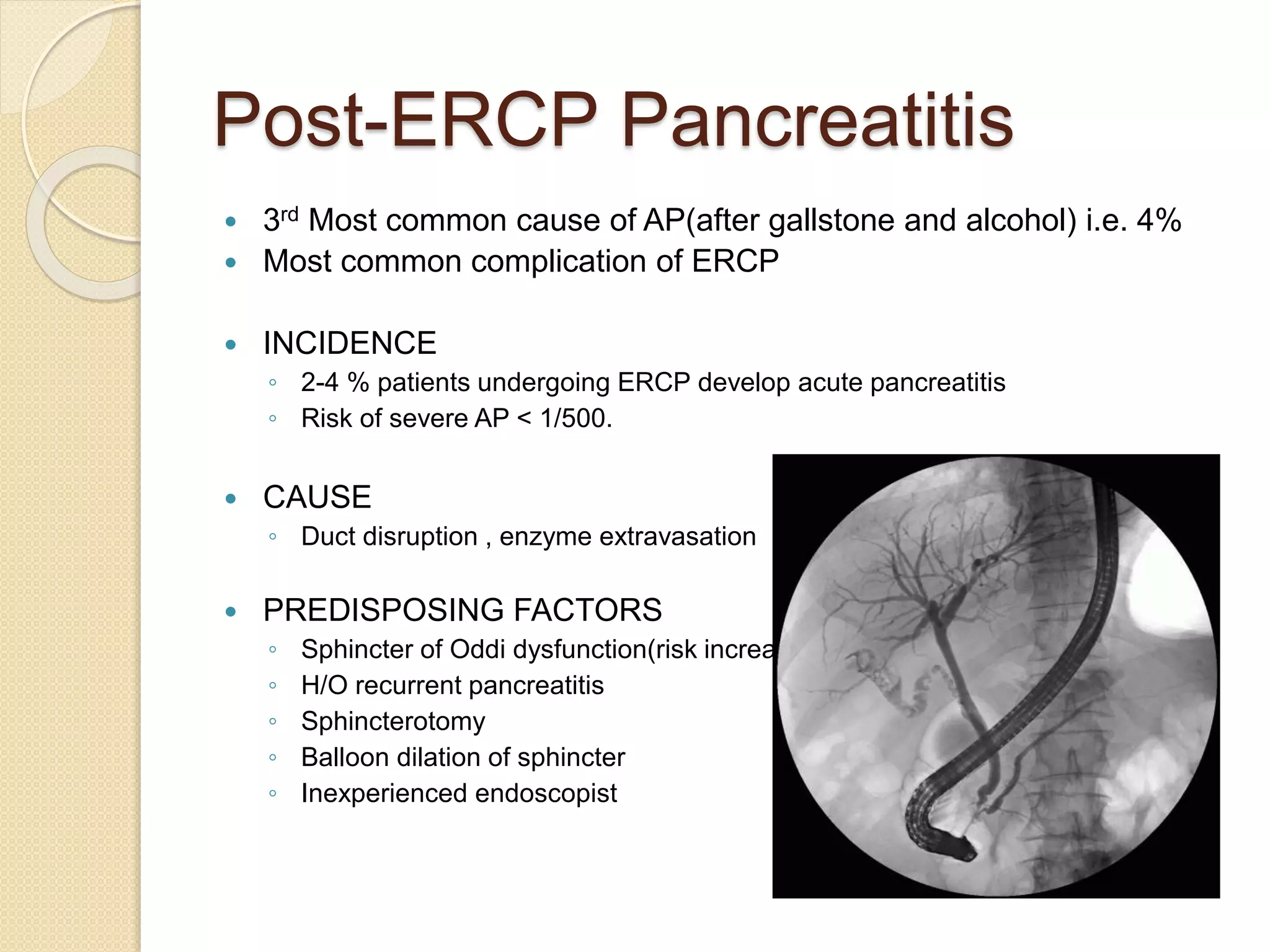 Acute pancreatitis.ppt