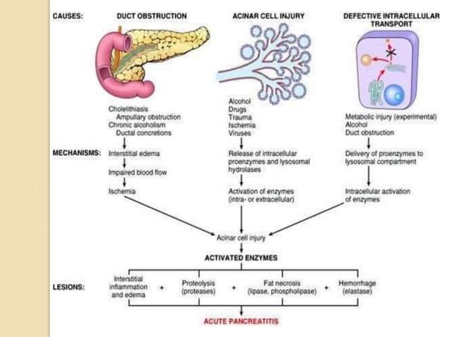 Acute pancreatitis.ppt