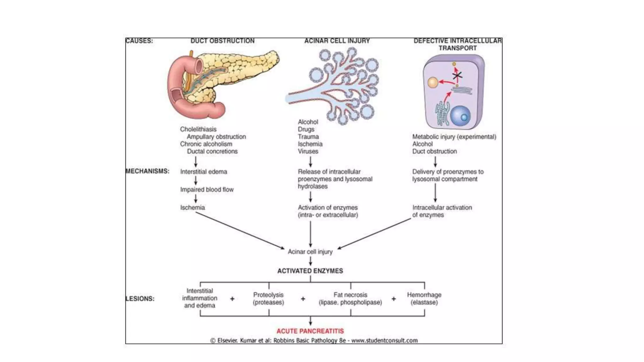 Acute pancreatitis anatomy pathogenesis and management | PPTX ...