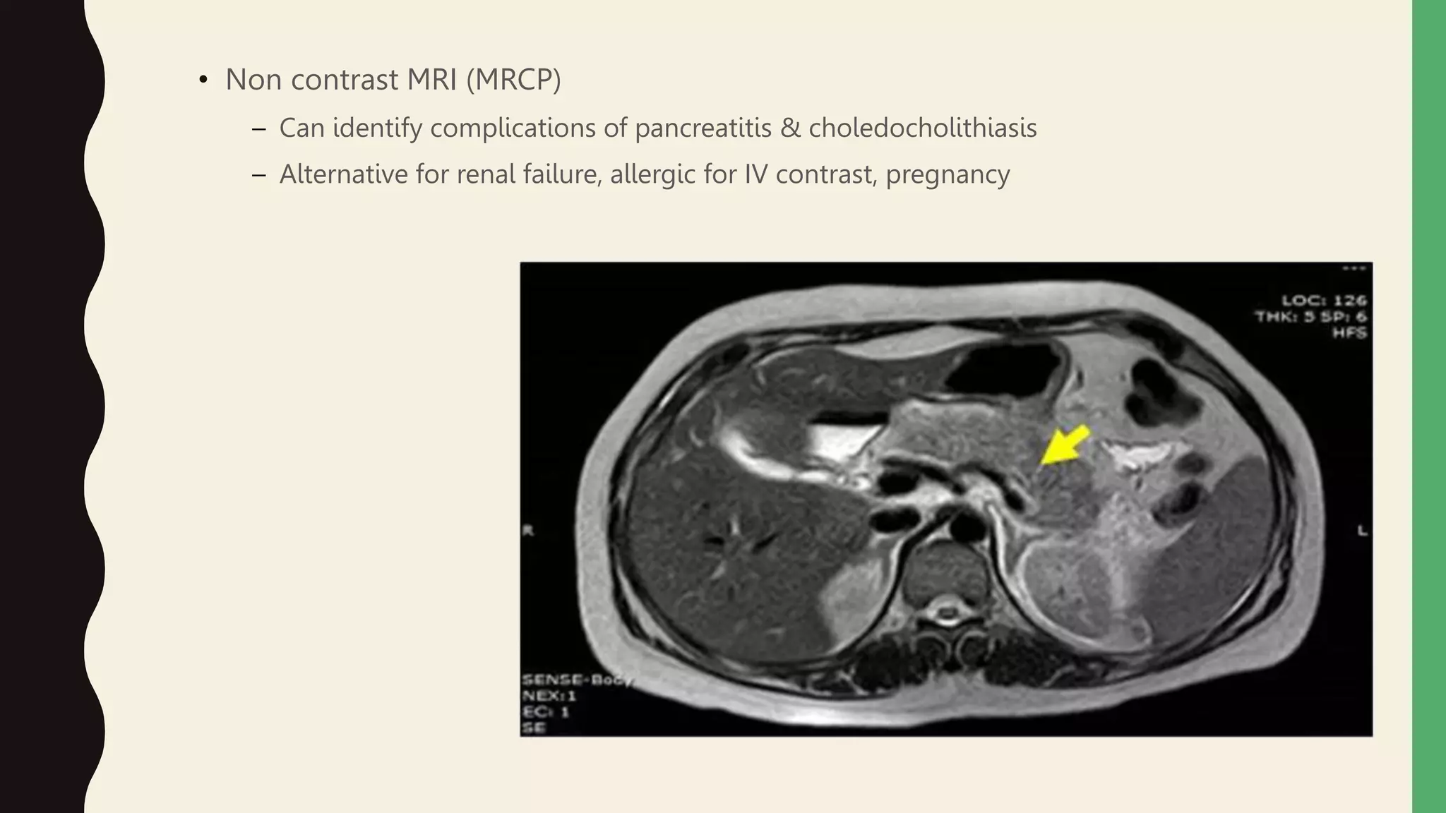 Acute Pancreatitis.pptx