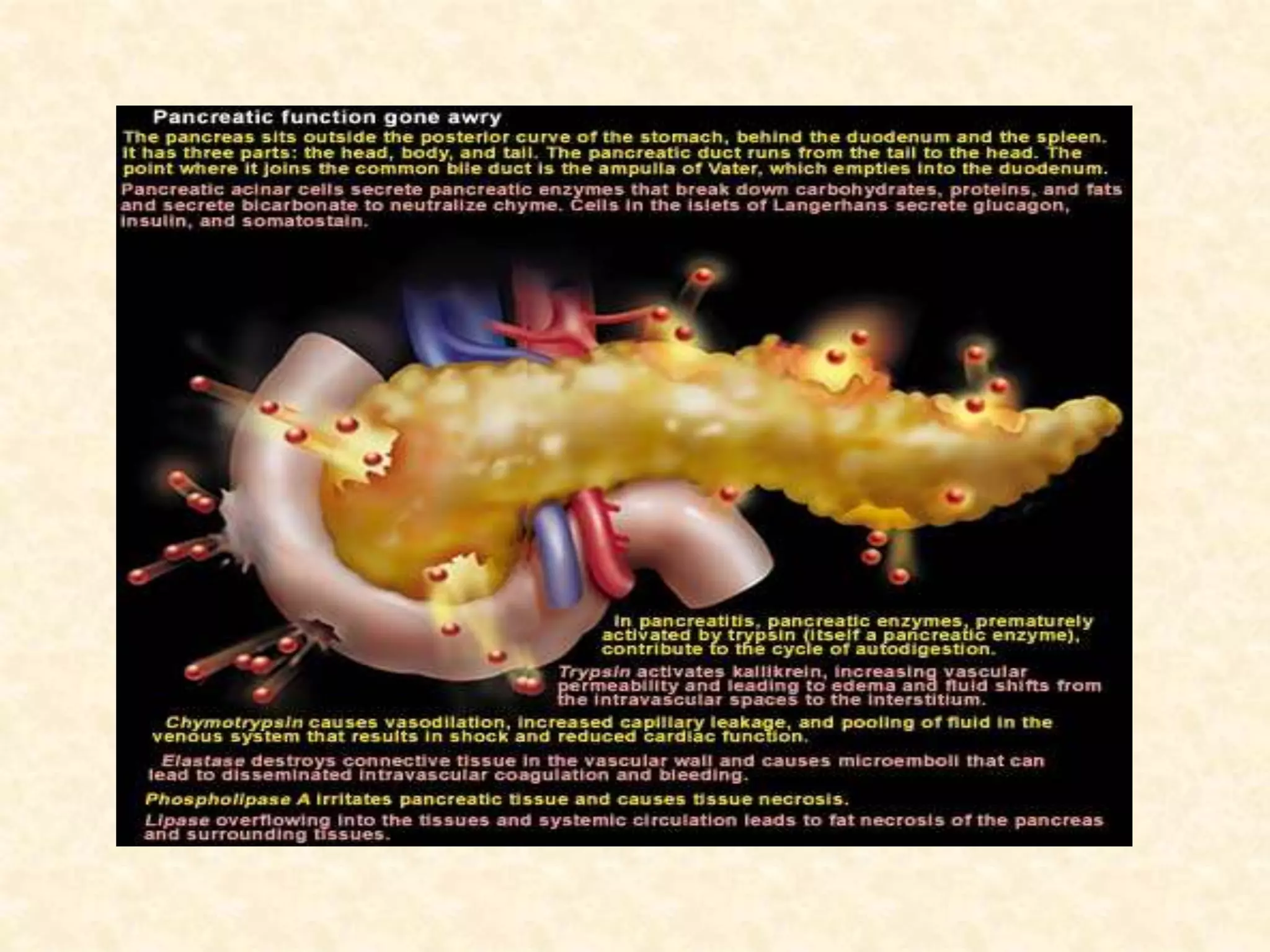 Acute Pancreatitis.ppt