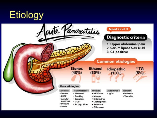 Acute pancreatitis.ppt