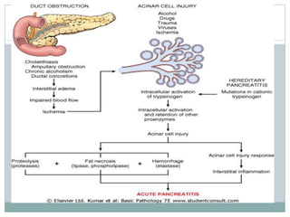 ACUTE PANCREATITIS.pptx