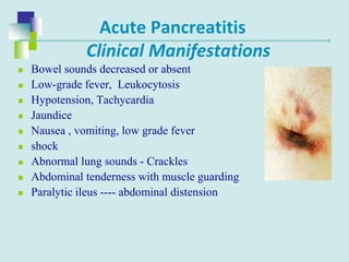 acute pancreatitis.ppt