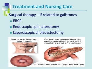 acute pancreatitis.ppt