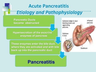 acute pancreatitis.ppt
