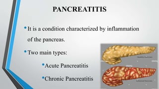 Acute Pancreatitis.pptx