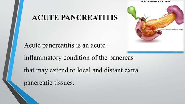 Acute Pancreatitis.pptx