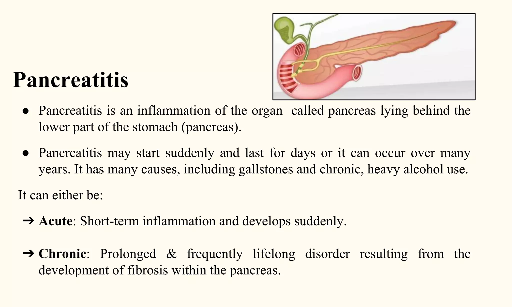 Acute pancreatitis.pptx